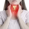 That small lump in your neck could tell a bigger story: Understanding ...