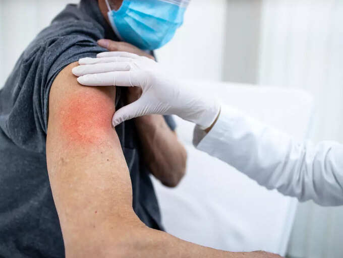 Coronavirus vaccination: Here's why you are asked to not rub or massage ...