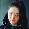 First Down’s syndrome model Ellie Goldstein who campaigned for Gucci ...