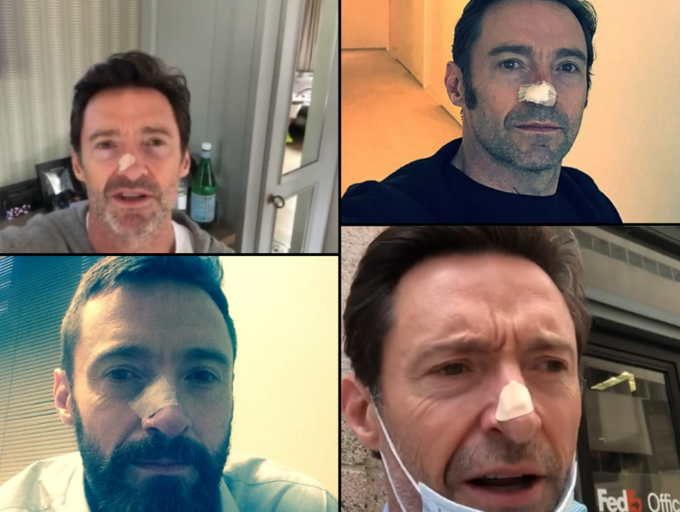 Actor Hugh Jackman urges people to wear sunscreen; had skin cancer SIX ...