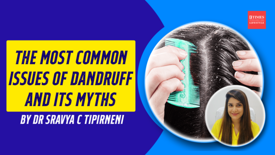 How to get rid of oily and sticky dandruff: 10 tips for a healthy scalp