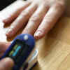 Coronavirus: THIS change in skin colour can indicate severe COVID-19 ...