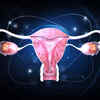 Some women have two vaginas; the condition is called 'uterus didelphys'
