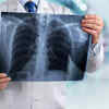 Lung Cancer Symptoms: Signs in your cough to watch out for