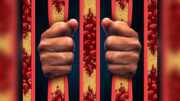 High cholesterol Symptoms: Two painful sensations to watch out for in ...