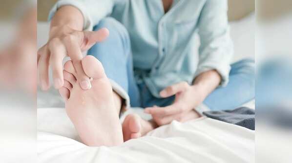 Coronavirus Symptom COVID toes: Who is more at risk of getting this ...