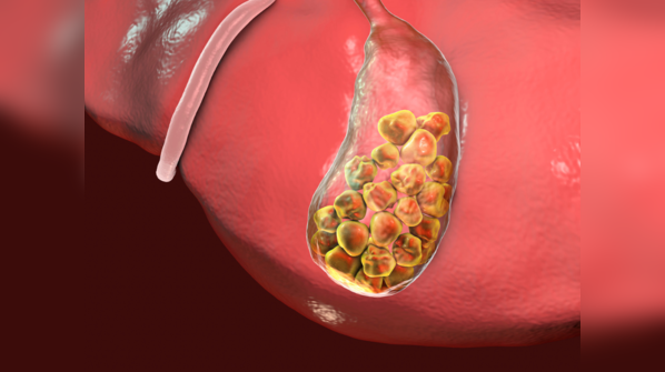 Bile Duct Cancer: Early warning signs of Bile Duct Cancer you must ...