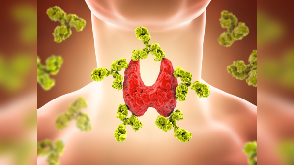 Hypothyroidism: How to lower your TSH through diet