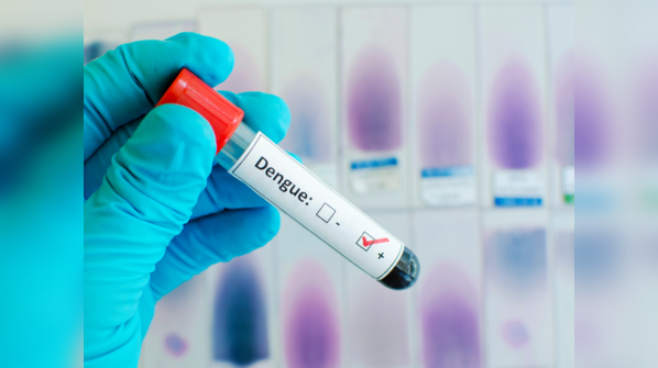 Dengue surge: All about dengue symptoms, tests, treatment and ...