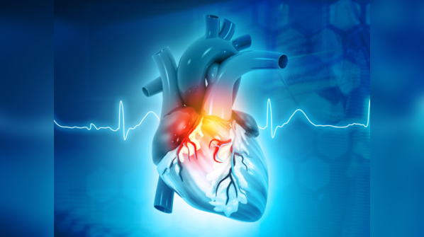 Heart Disease : 10 rare heart conditions you might not have heard of ...