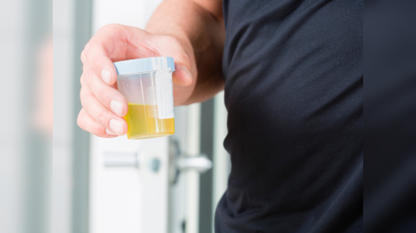 Here’s what your urine colour is telling you about your health