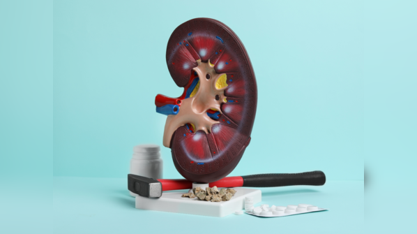 Chronic Kidney Disease: 6 stages of chronic kidney disease and how it ...