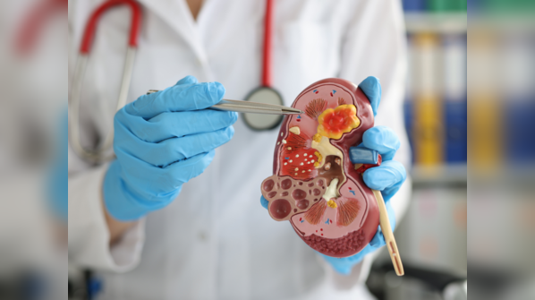 Itchy skin and unusual rashes can signal towards kidney disease