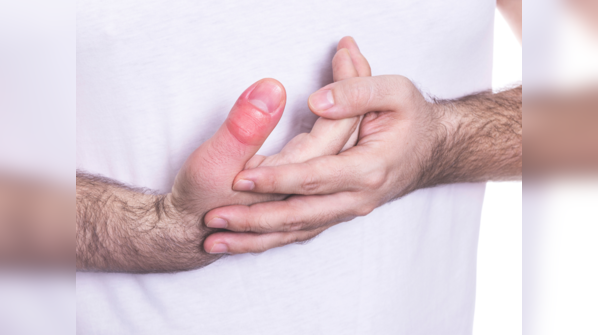 Swelling in these 5 body parts can be a 'severe' fatty liver disease sign