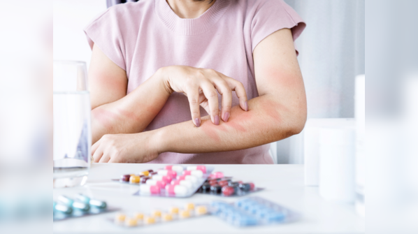 Collagen Side Effects: 6 side effects of collagen supplements that are ...