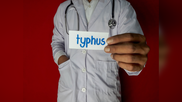 Typhus: Texas man loses hands and feet from a SINGLE flea bite; almost ...