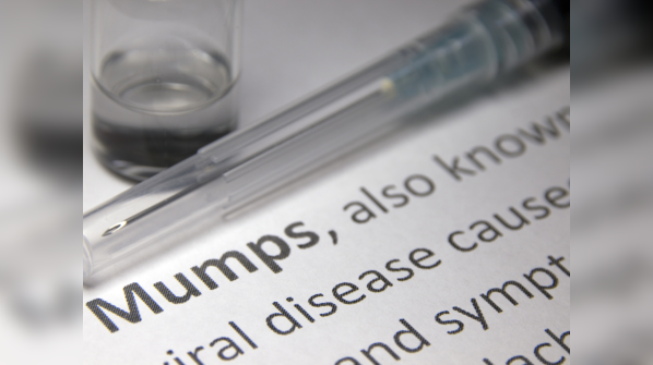Early Symptoms Of Mumps: Swelling on the face could be mumps; early ...