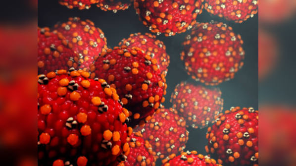 Mumps Symptoms: All about the symptoms and prevention tips for the ...