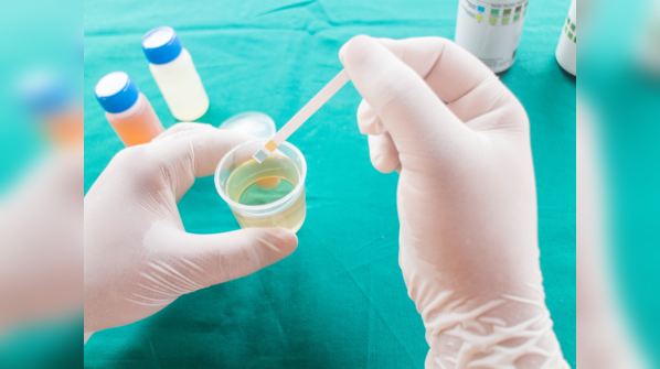 Here’s what your urine colour is telling you about your health