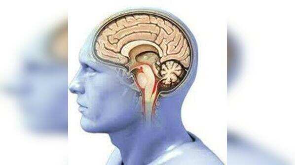 What is Cotard's syndrome? The rare mental illness which makes people ...