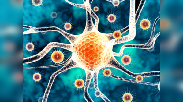 Mumps Symptoms: All about the symptoms and prevention tips for the ...