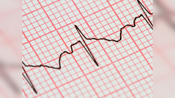 Heart Problems Tests: 5 medical tests that can help detect heart problems