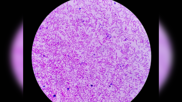 UK sees rise in 'extensively antibiotic-resistant' Shigella infection ...