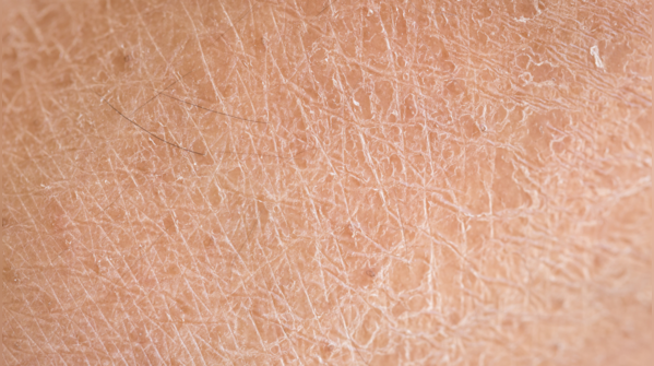 What the skin REVEALS about internal health: 5 signs that should never ...