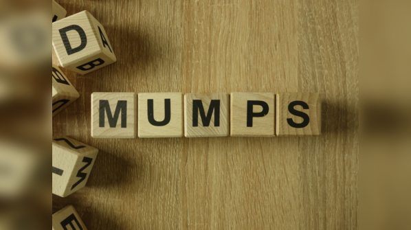 Early Symptoms Of Mumps: Swelling on the face could be mumps; early ...