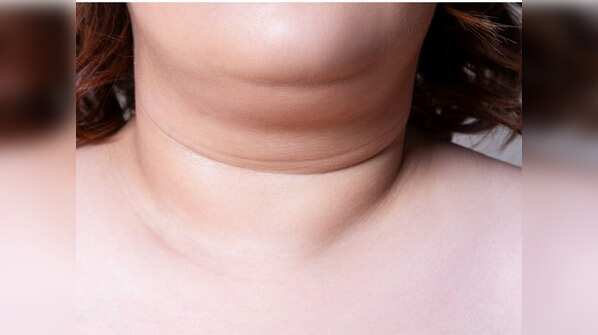 Double Chin Exercises: Hate double chin? Do these 7 Exercises to Get ...