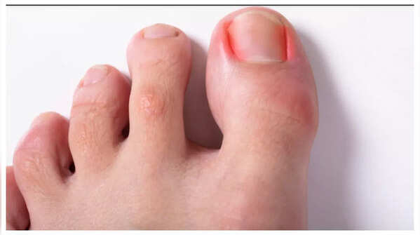 What do your feet say about your health?