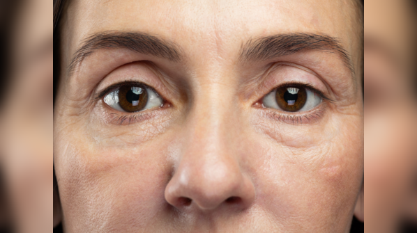 Signs of fatty liver on face and skin