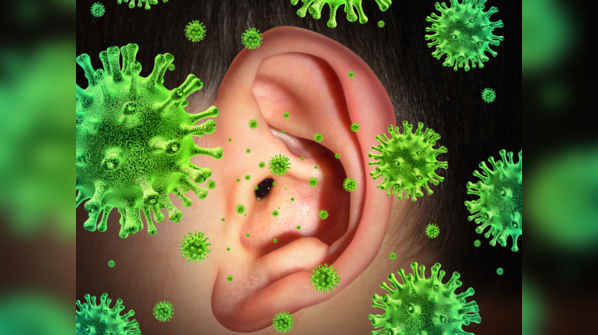 Ear Infection Cases: After conjunctivitis, fungal ear infection cases ...