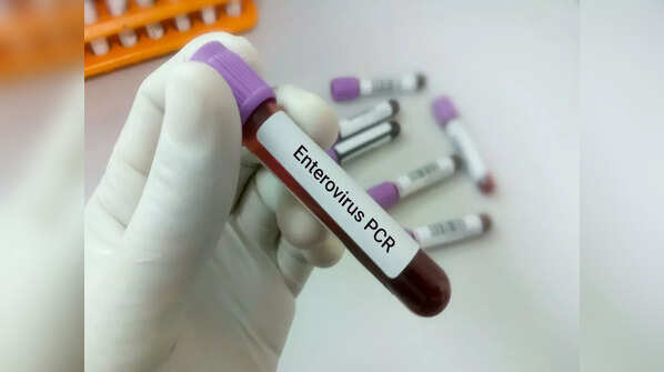 US sees rise in respiratory infection that can lead to paralysis in ...