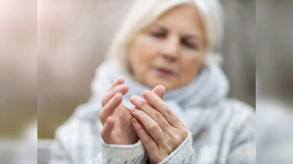 Osteoarthritis Synonyms: The sign that appears in your hand