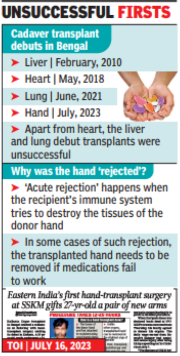 After Transplant, Man’s Body Rejects Right Hand, Docs Try To Save The ...