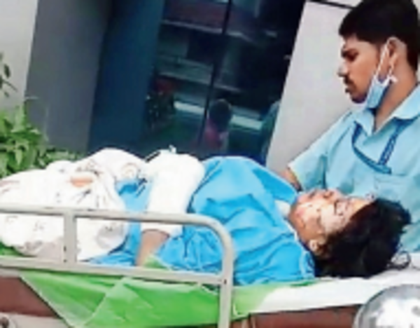 College: College girl suffers 35% burns as pole collapses in Bengaluru ...
