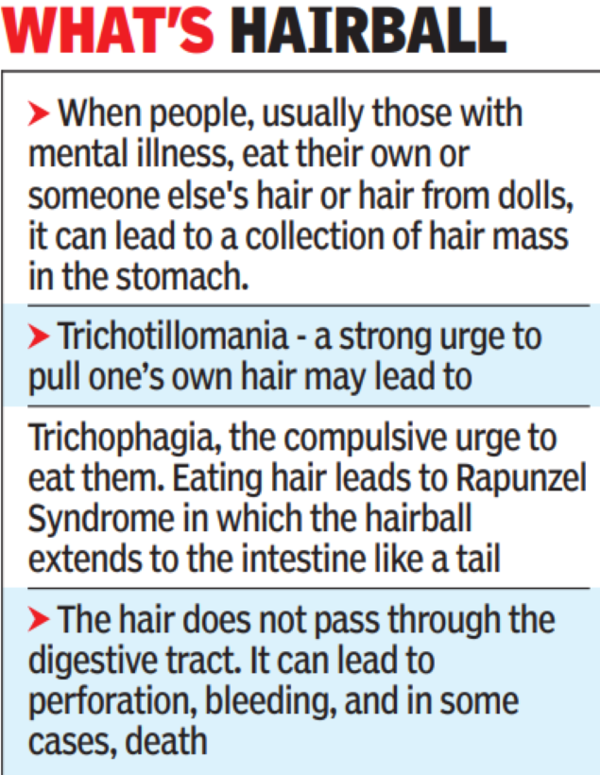 Hairball surgically removed from teen's gut | Chennai News - Times of India