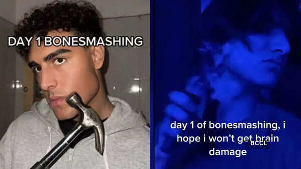 Bone Smashing: Understanding the risky trend of 'Bone Smashing ...