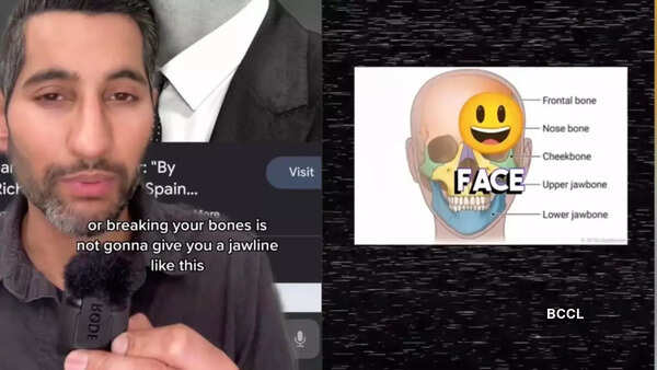 Bone Smashing: Understanding the risky trend of 'Bone Smashing ...