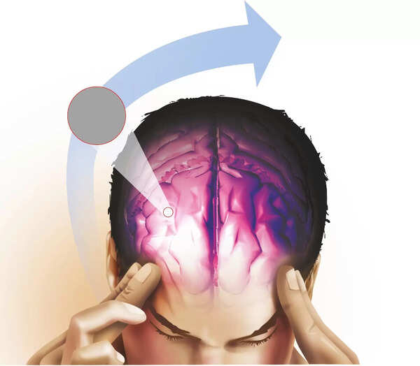 Mumps: Rising Cases Of Mumps Raise Concerns Among Docs | Vadodara News ...