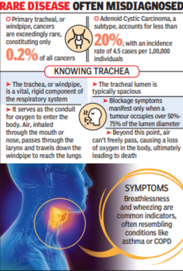 Trachea Cancer: Trachea Cancer: Misdiagnosed as Asthma for 2 Years ...