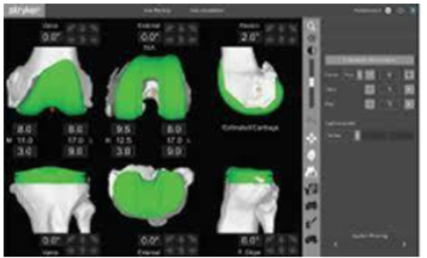 Patna may soon become the hub of robotic joint replacements: Dr Ashish ...
