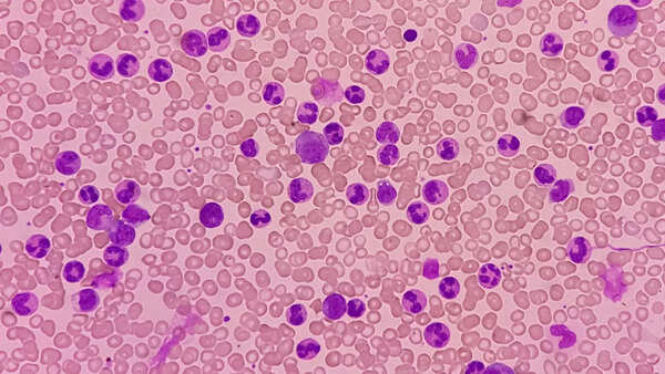 Cancer-causing chemicals found in 527 Indian food items by EU food ...