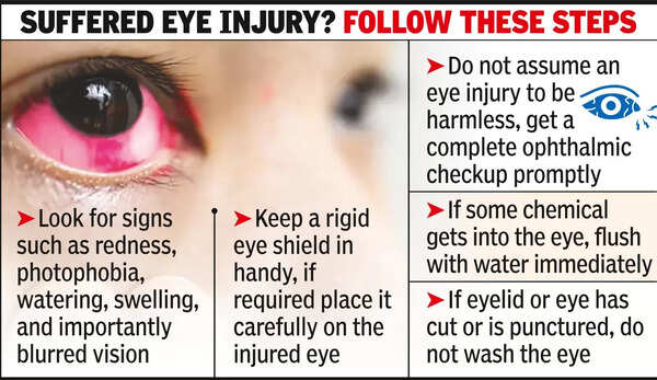 Eye Injuries: Experts: Eye Injuries In Sports Common, But Less Talked ...