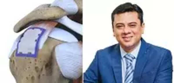 Bio-inductive patch revolutionizes rotator cuff tear treatment - Times ...