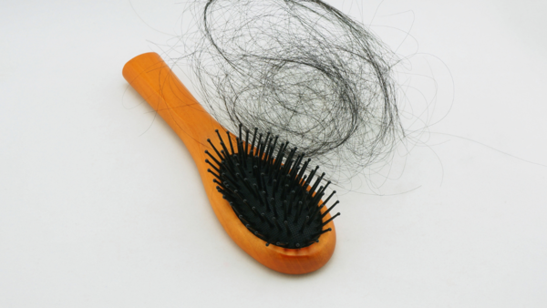 Hair Loss Reasons: 5 serious causes that may be causing hair fall ...
