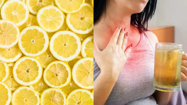 7 Reasons why Lemons may not be suitable for everyone - Times of India