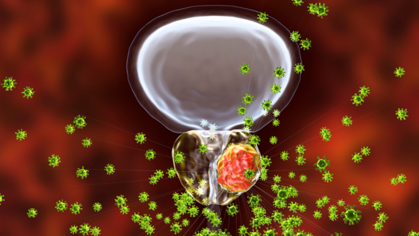 5 signs of prostate cancer you shouldn't ignore - Times of India