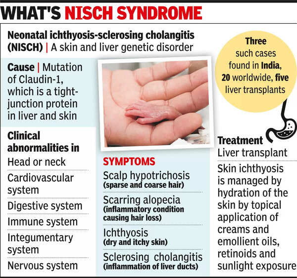 Genetic Disorder: 2-month-old boy diagnosed with extremely rare genetic ...